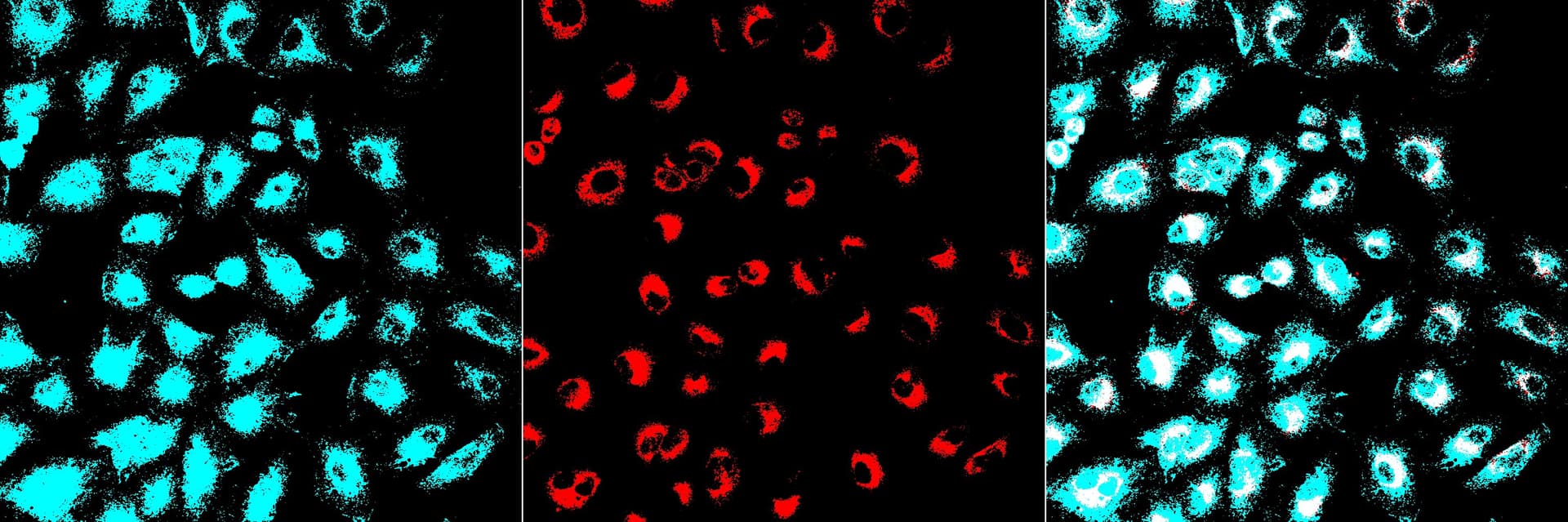 How to measure Endoplasmic Reticulum sheet Vs tubule area? - Image ...