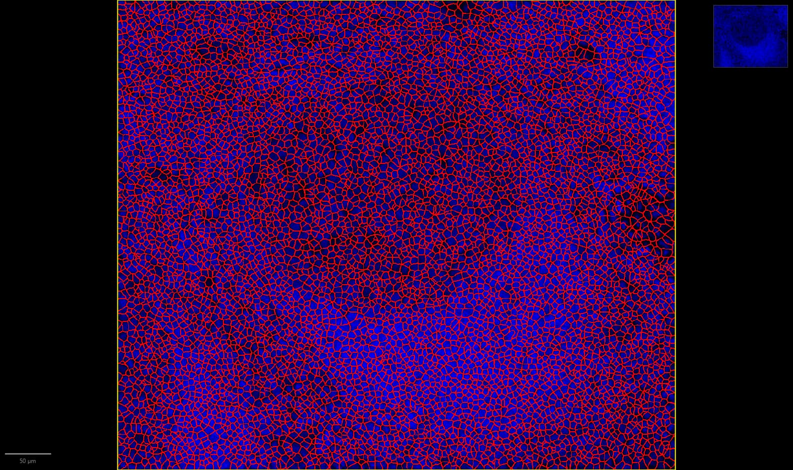 Cell detection other than DAPI on IF - Image Analysis - Image.sc Forum