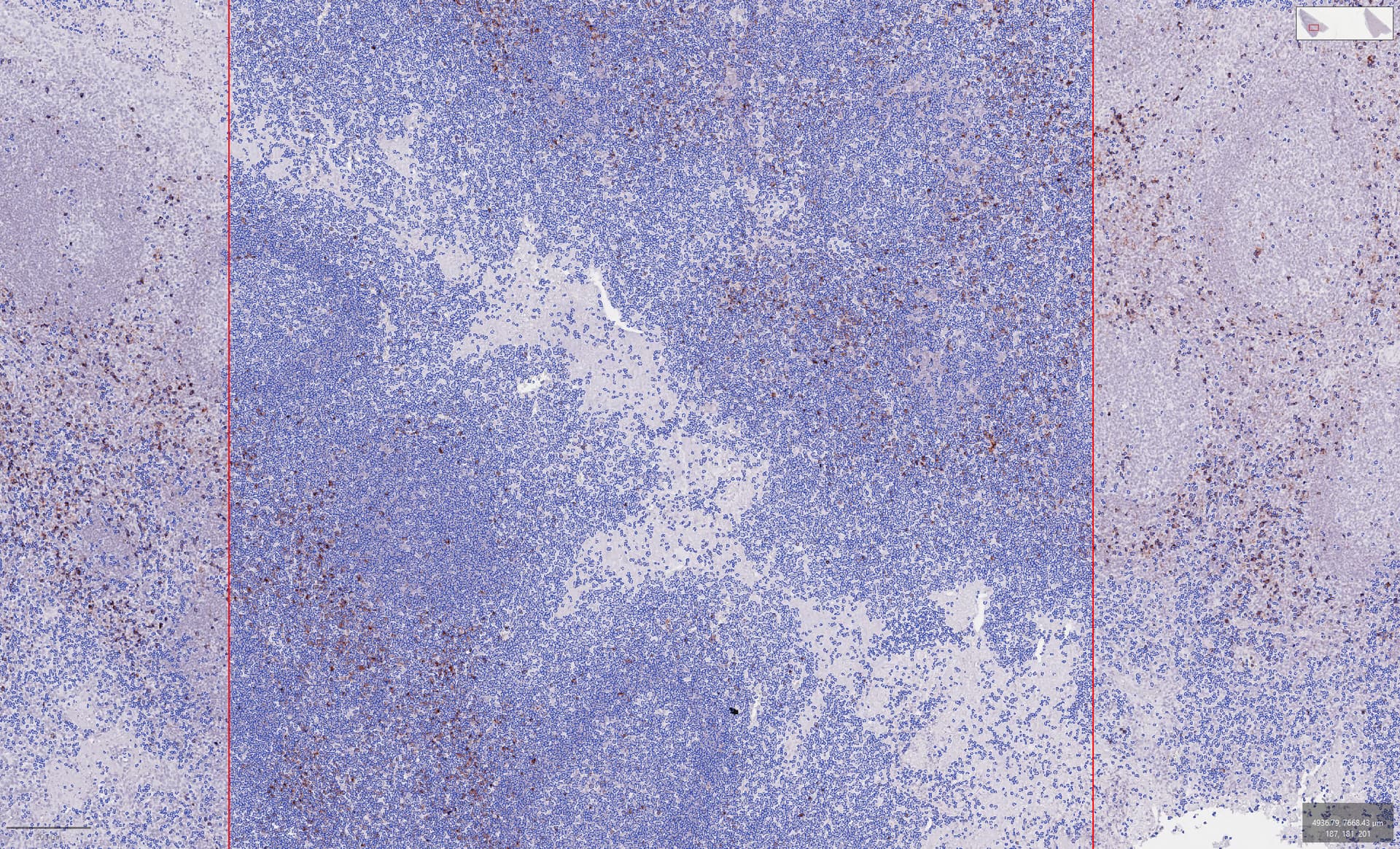 Cellpose Extension In Qupath Cannot Get Deconvolution And Normalization Working Together