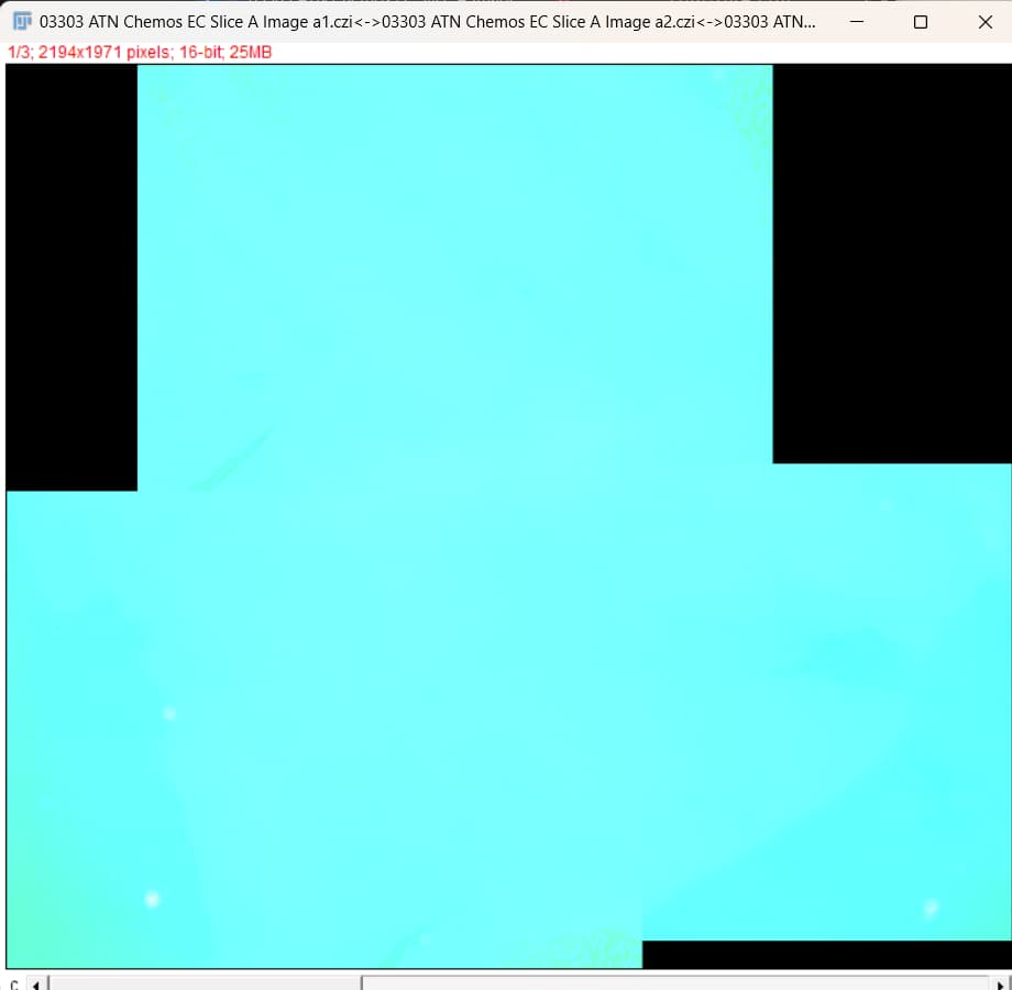 Issues with Stitching (.czi files) - Image Analysis - Image.sc Forum