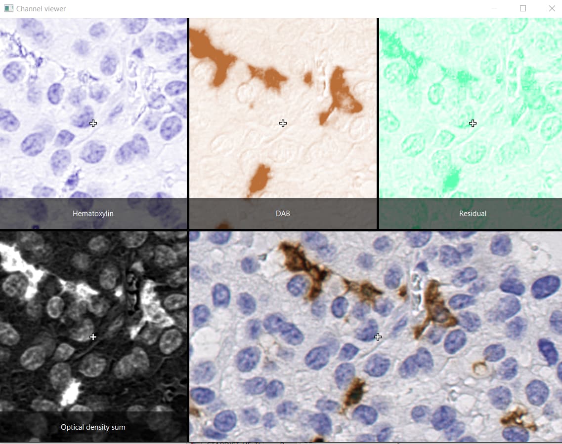 QuPath Cellpose2 on deconvolved channels - Image Analysis - Image.sc Forum