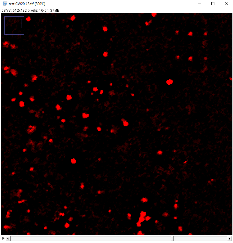 Correcting focus drift using ImageJ - Image Analysis - Image.sc Forum