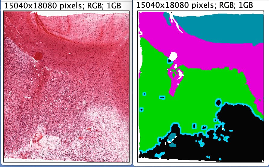 Overlaying H&E and Tissue Annotations in QuPath - Image Analysis - Image.sc Forum