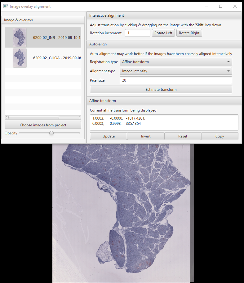 QuPath- Multiple Image Alignment and Object Transfer - Image Analysis - Image.sc Forum