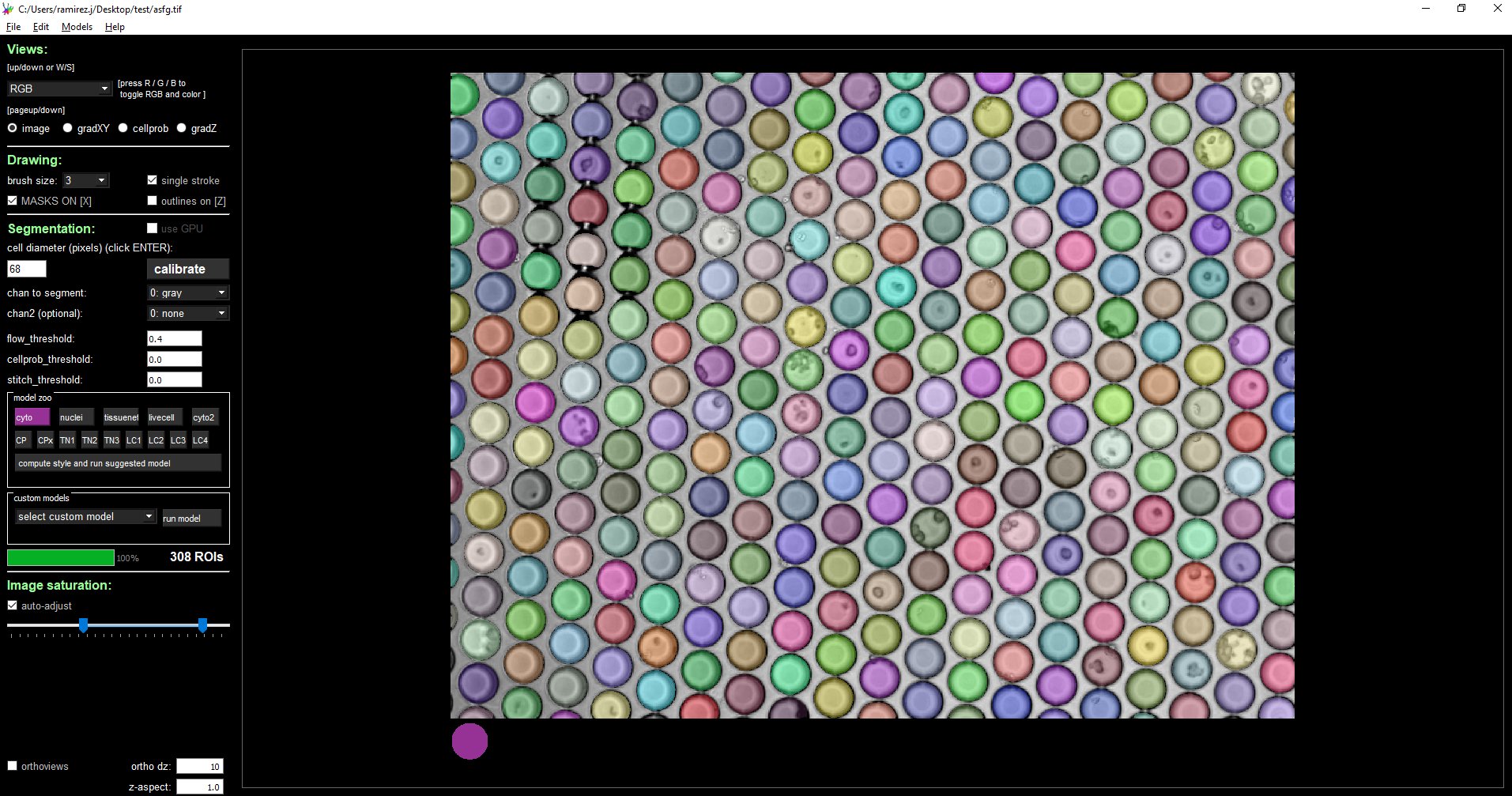 How to close the circles in imageJ - Image Analysis - Image.sc Forum