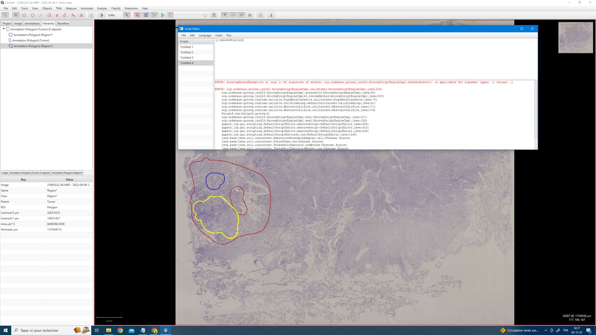 Remove an annotation from hierarchy - Image Analysis - Image.sc Forum