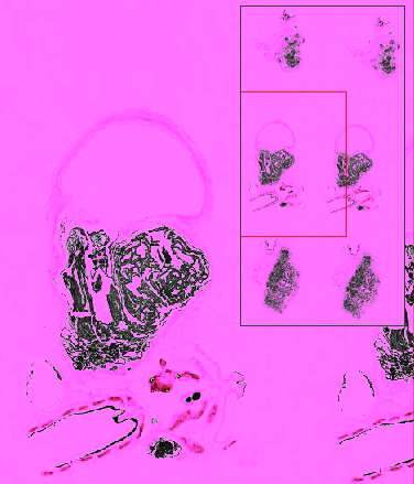 .svs files all pink when loaded in QuPath 0.3.1 - Usage & Issues ...