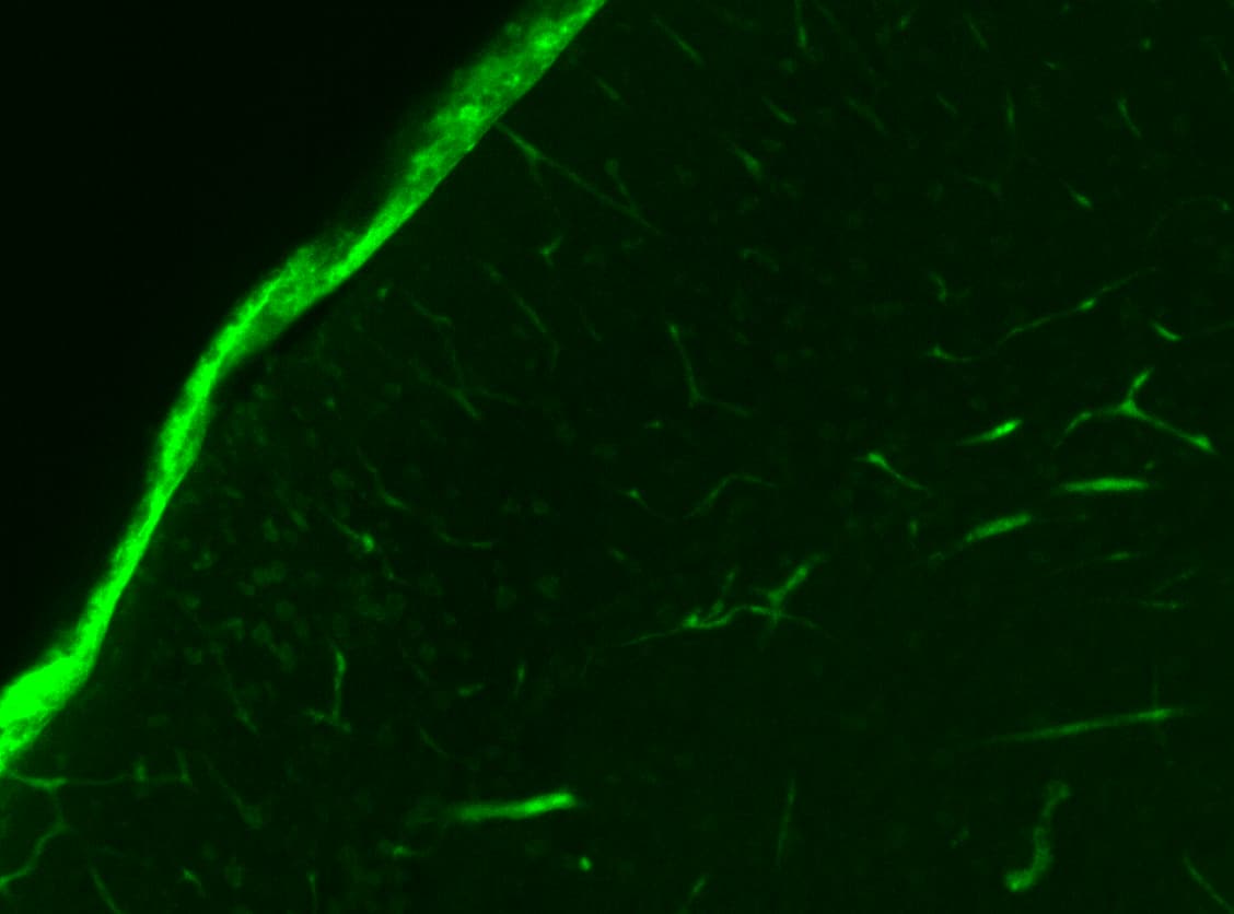 Vessel Segmentation in 3D or 2D with ML or DL - Image Analysis - Image ...