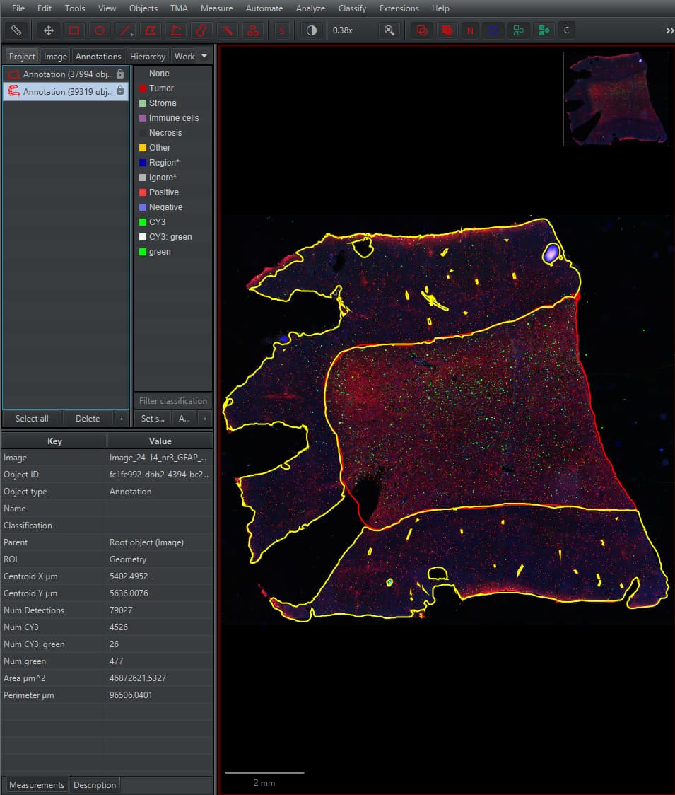 Stardist Cell detection + size filter + classification = different ... Stardist Cell detection + size filter + classification = different ...