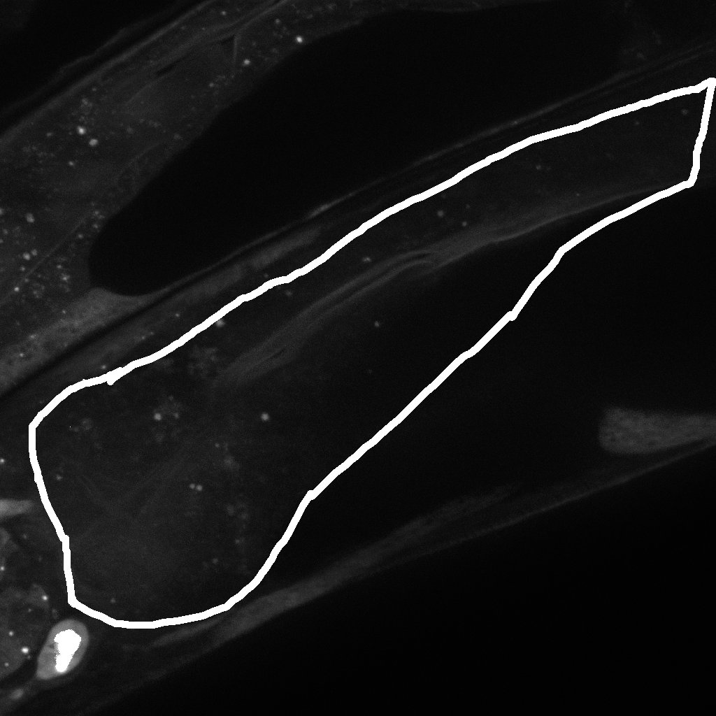 Segmentation of very close puncta - Image Analysis - Image.sc Forum
