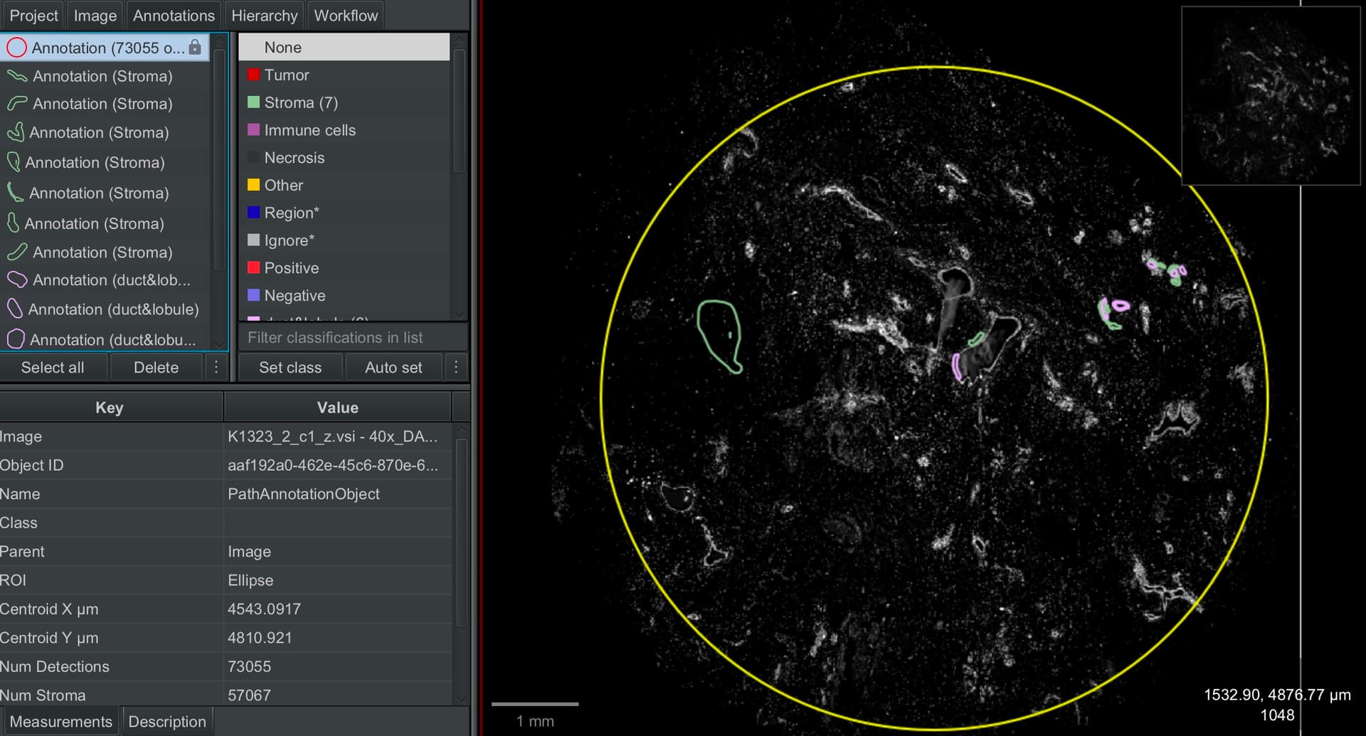 Unable to import annotation files (QuPath; geoJSON) into TissUUmaps 3.1 correctly - Usage ...