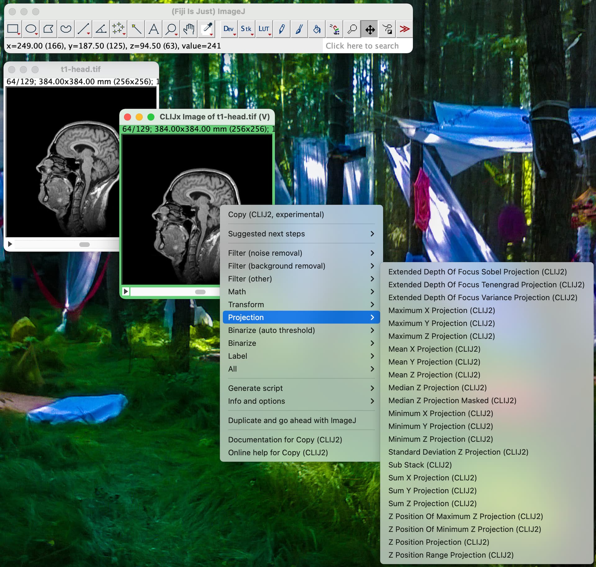 ImageJ GUI project along x or y axis - Usage & Issues - Image.sc Forum