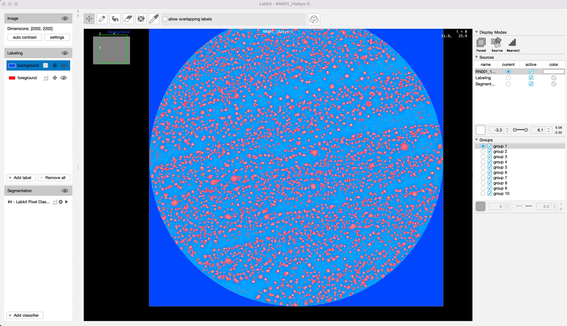 Using ImageJ to measure surface area growth on petri dishes - Image Analysis - Image.sc Forum
