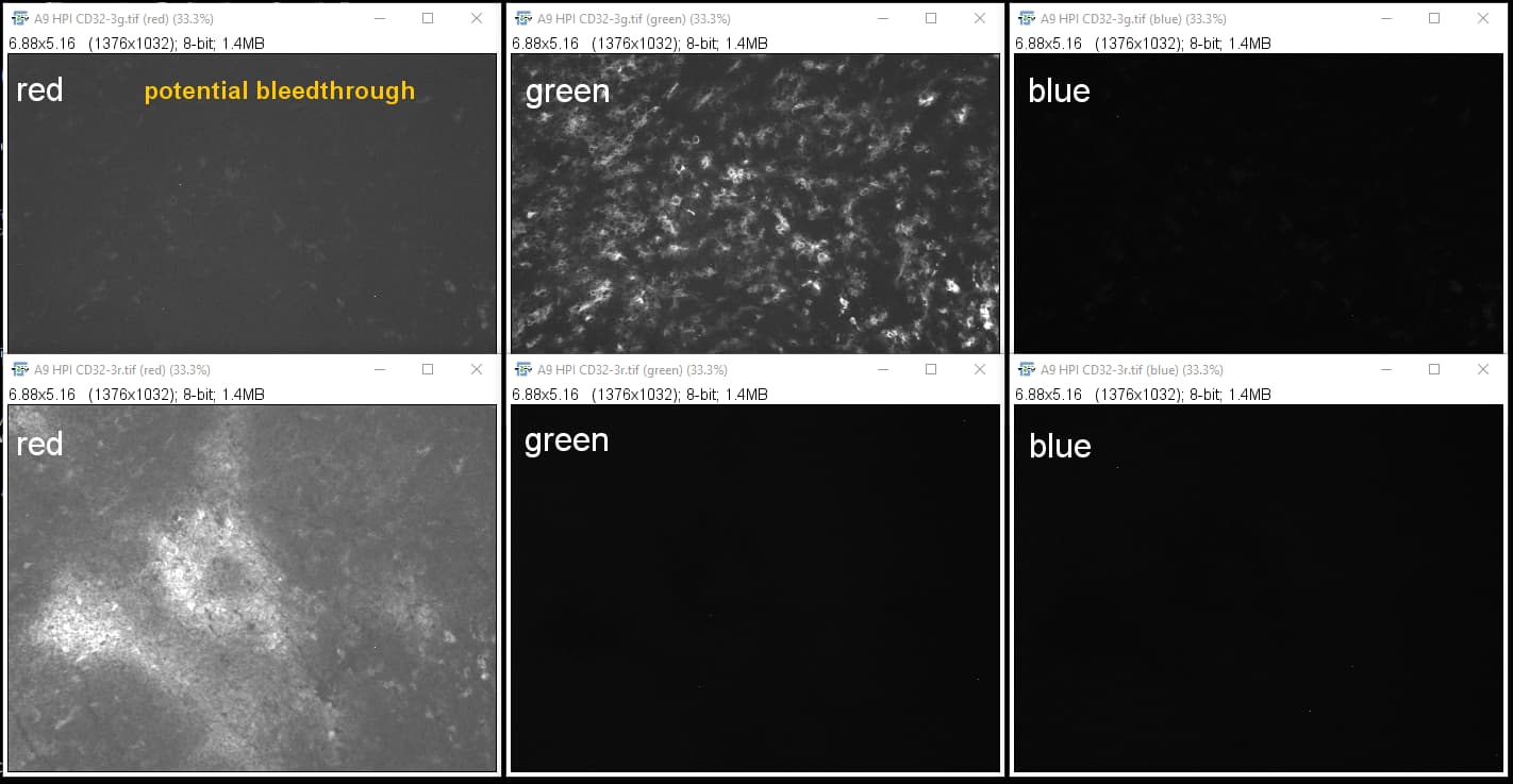 ImageJ Coloc 2 with tissue sections - Image Analysis - Image.sc Forum