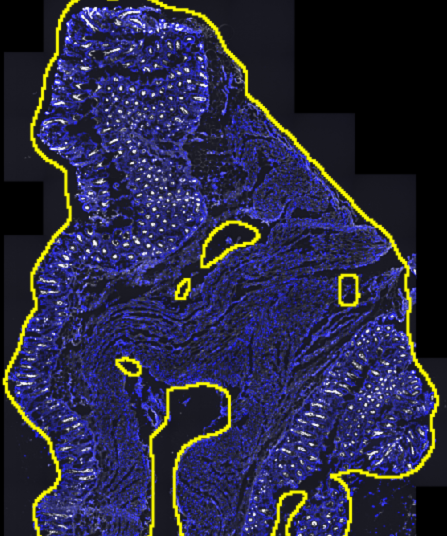 Whole Image Intensity Using Qupath Image Analysis Imagesc Forum