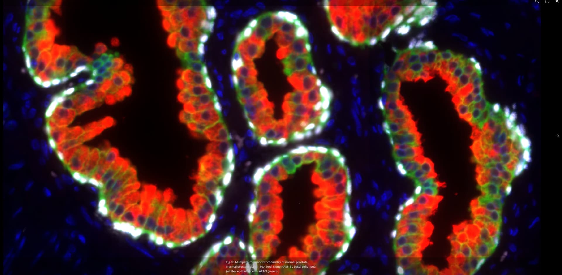 Measuring cytoplasmic intensity in tissue stained with GFP (and nuclei ...