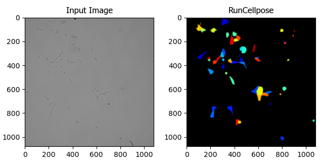 Identifying SHSY5Y derived neurons with Brightfield Images - Image Analysis - Image.sc Forum