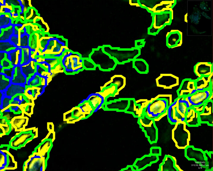 Combine multiple cell segmentations in Cellpose - Image Analysis - Image.sc Forum