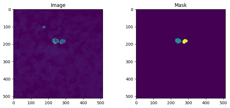 Segmentation (cellpose) with noise - Image Analysis - Image.sc Forum