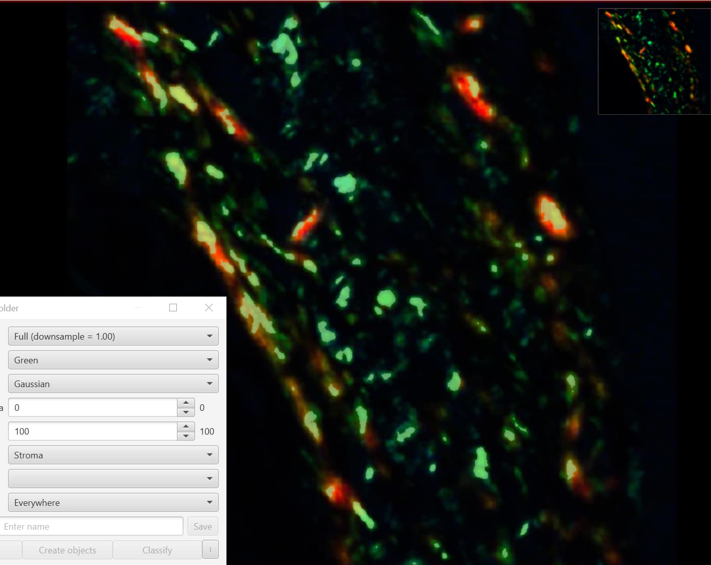 Analysing Picrosirius red stain (polarised light) using qupath - Image Analysis - Image.sc Forum