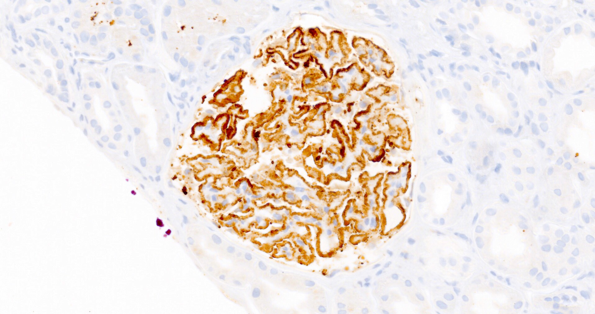How to measure the area and intensity of IHC staining, as well as ...