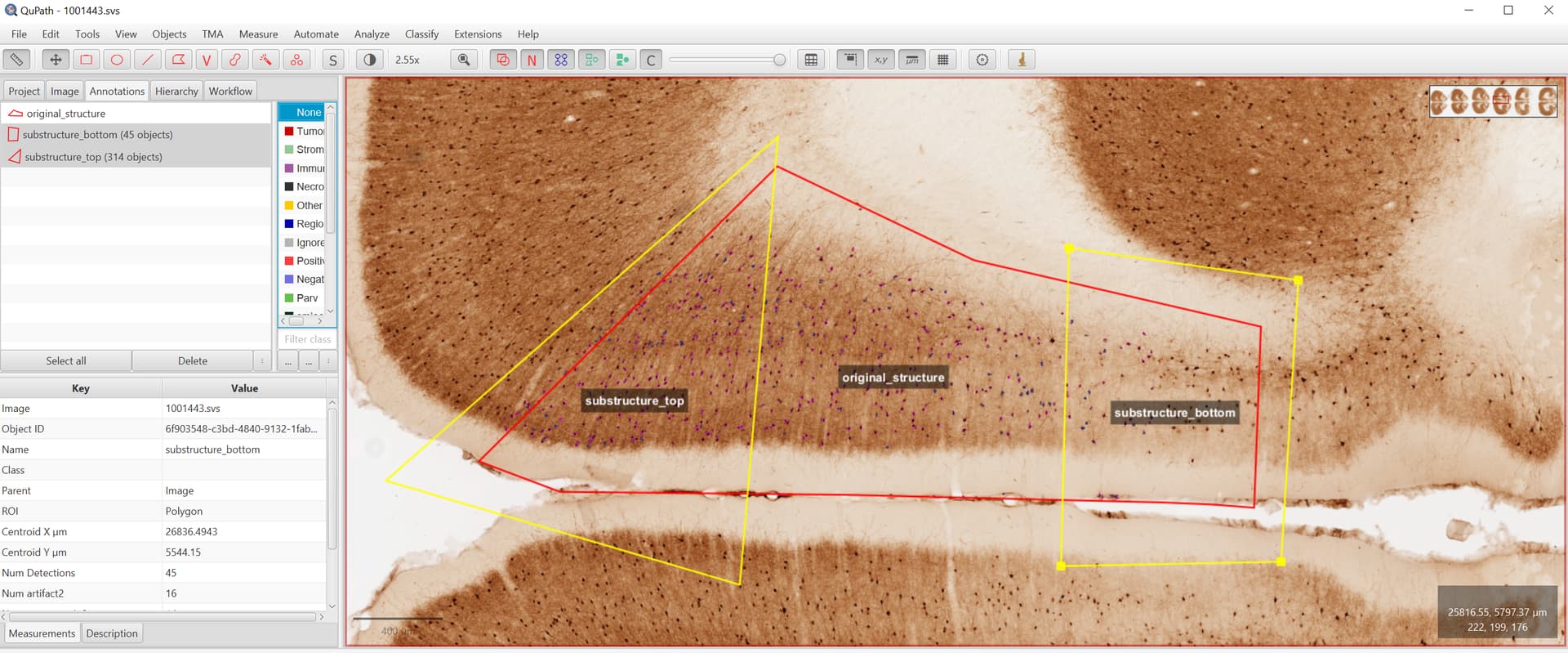 Qupath Intersect Annotations And Keep Original Object Usage And Issues Image Sc Forum