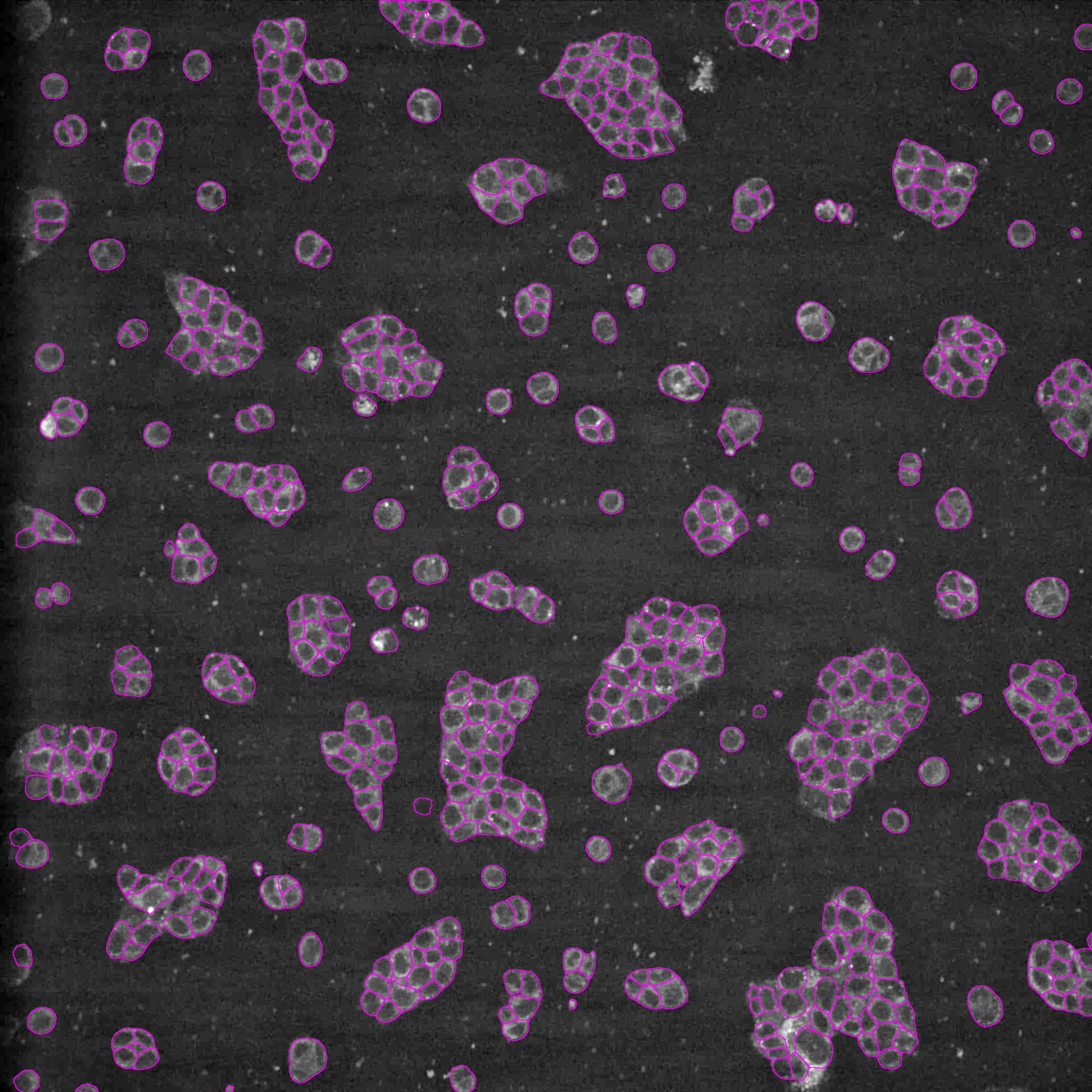 Difficulties with segmentation of clumped cells - CellProfiler - Image Analysis - Image.sc Forum