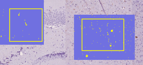 Trouble using Pixel classifier applied to annotations - Image Analysis - Image.sc Forum