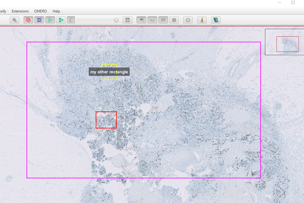 Exporting NDPI.NDPA annotation files from QuPath (code attached) - Page 2 - Development - Image ...