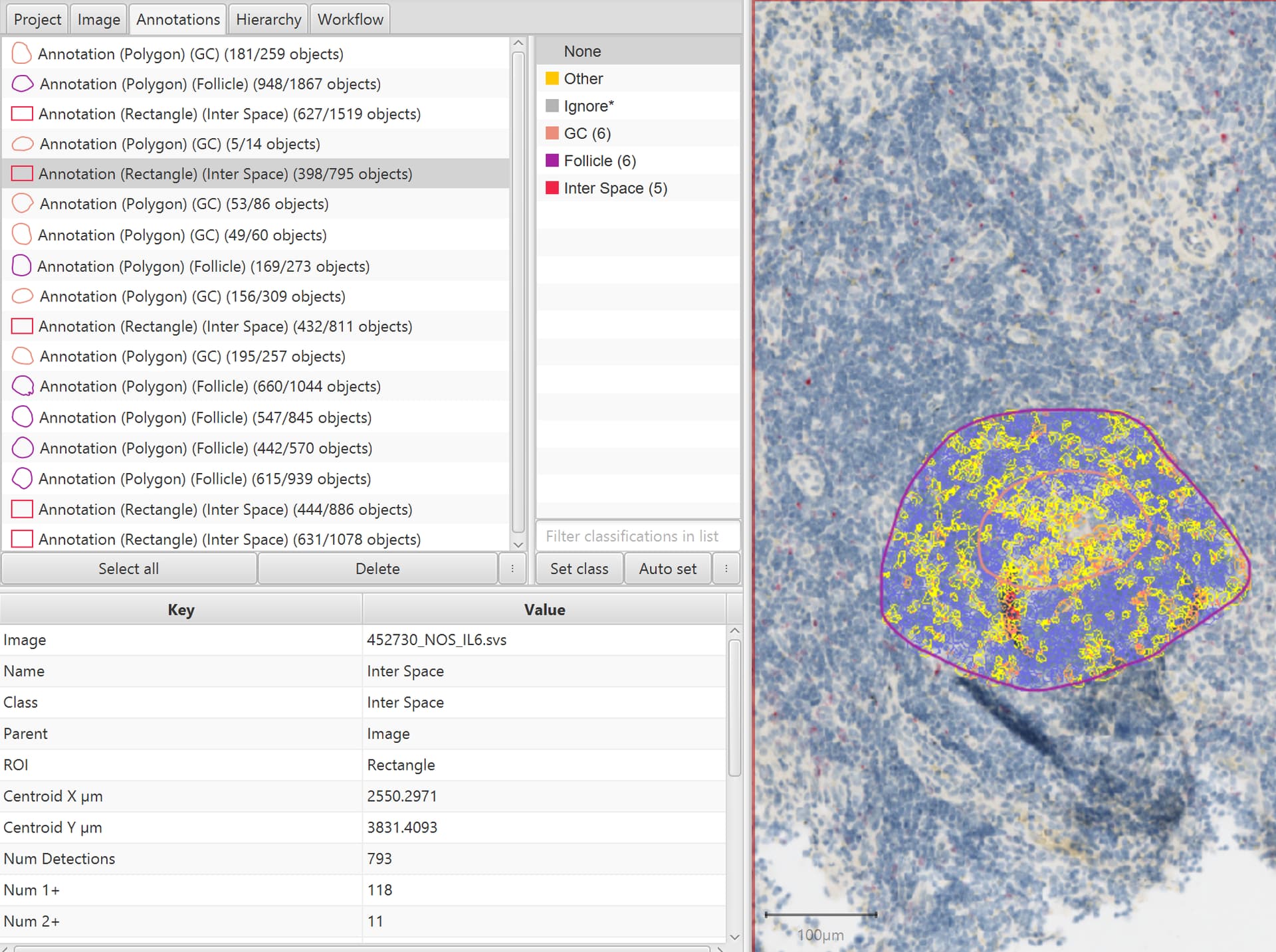 RNAScope Duplex probe counting spots per cell using Qupath - Image Analysis - Image.sc Forum