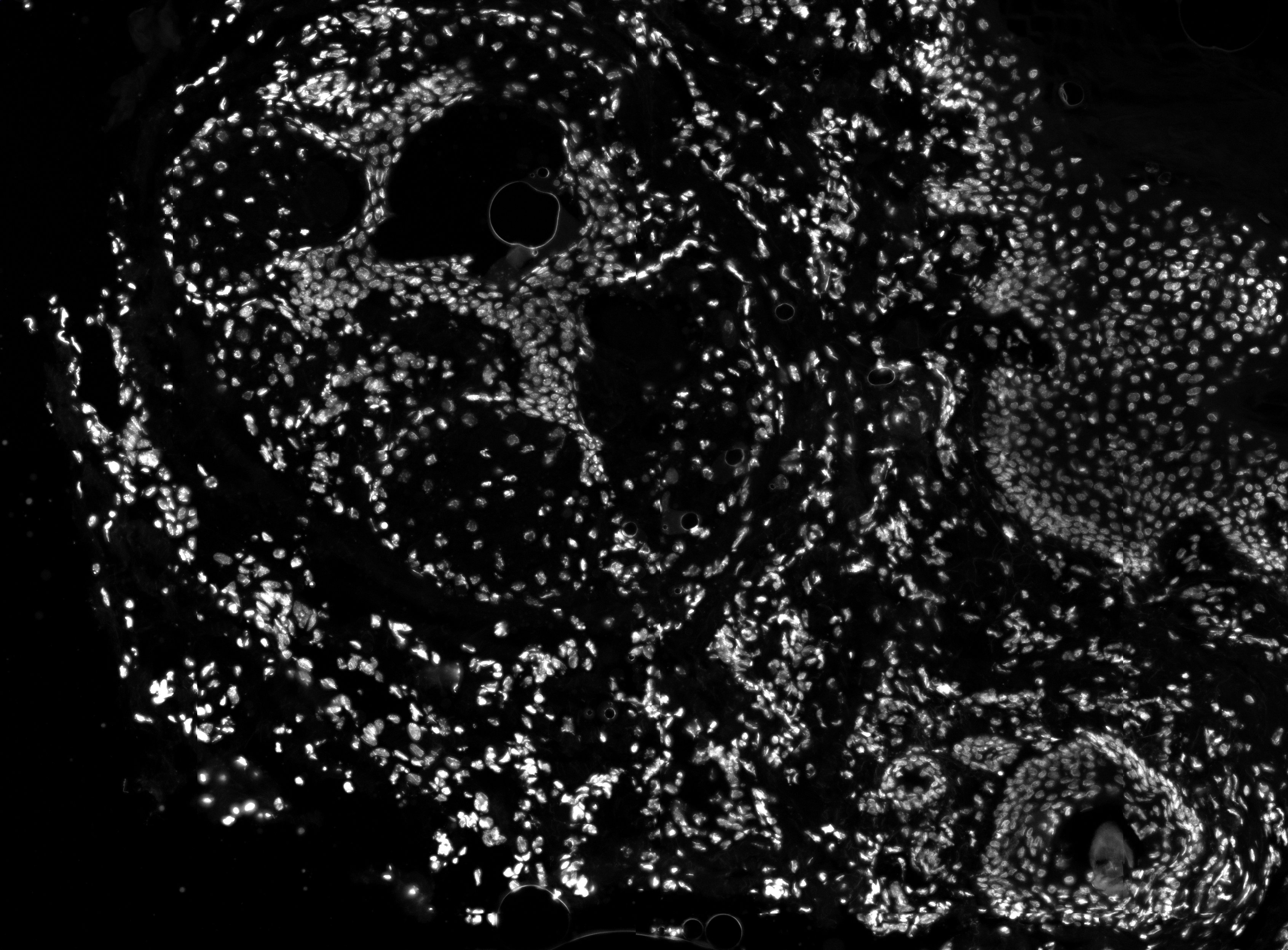Qupath: Fluorescent image analysis using colocalization of objects in different channels - Image ...