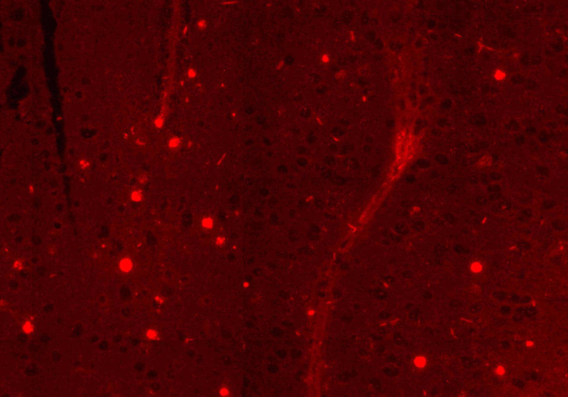Identifying Double Positive Cells Stained with IHC and RNA ISH - Image ...