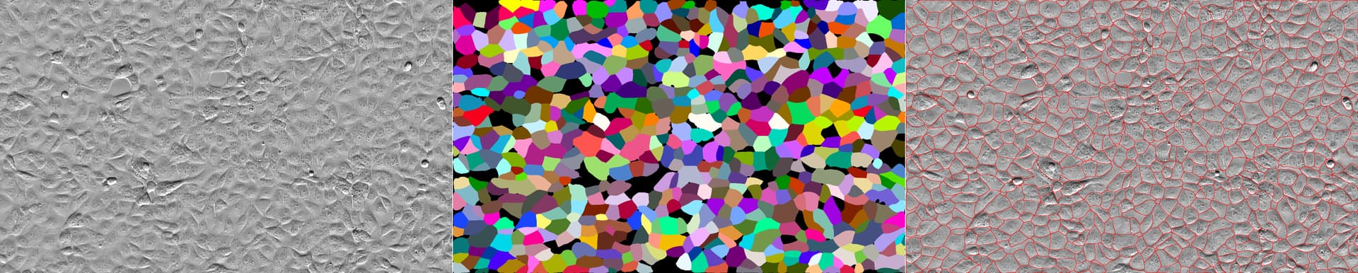 Segmenting cell image from CD7 microscope - Image Analysis - Image.sc Forum