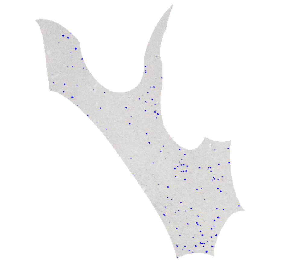 Using Trainable Weka Segmentation to segment cfos-ir cells in an image - Image Analysis - Image ...