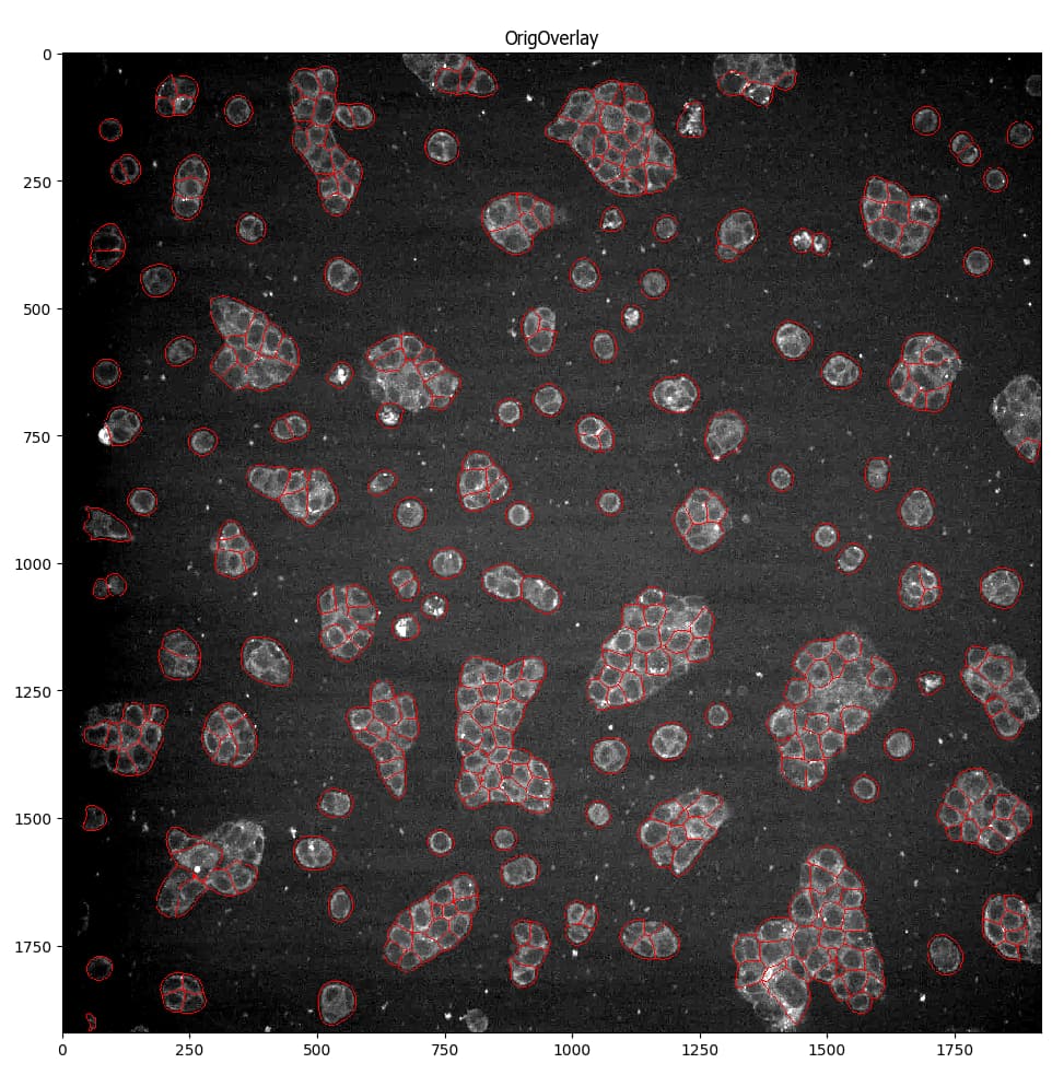 Difficulties with segmentation of clumped cells - CellProfiler - Image Analysis - Image.sc Forum
