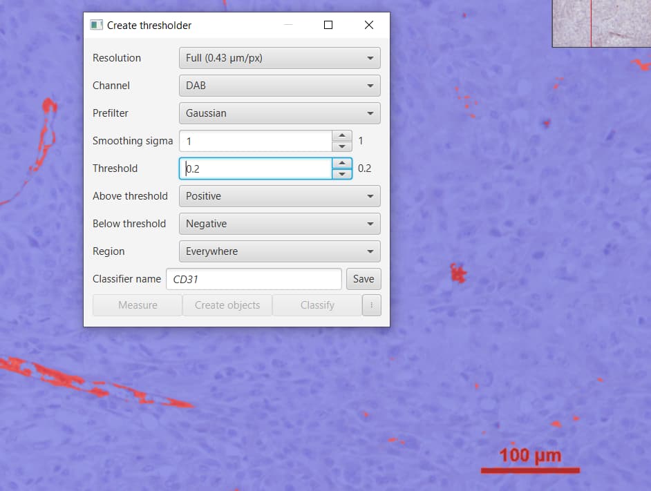 Unwanted selection of the scale-bar when detecting the positive area in QuPath - Usage & Issues ...