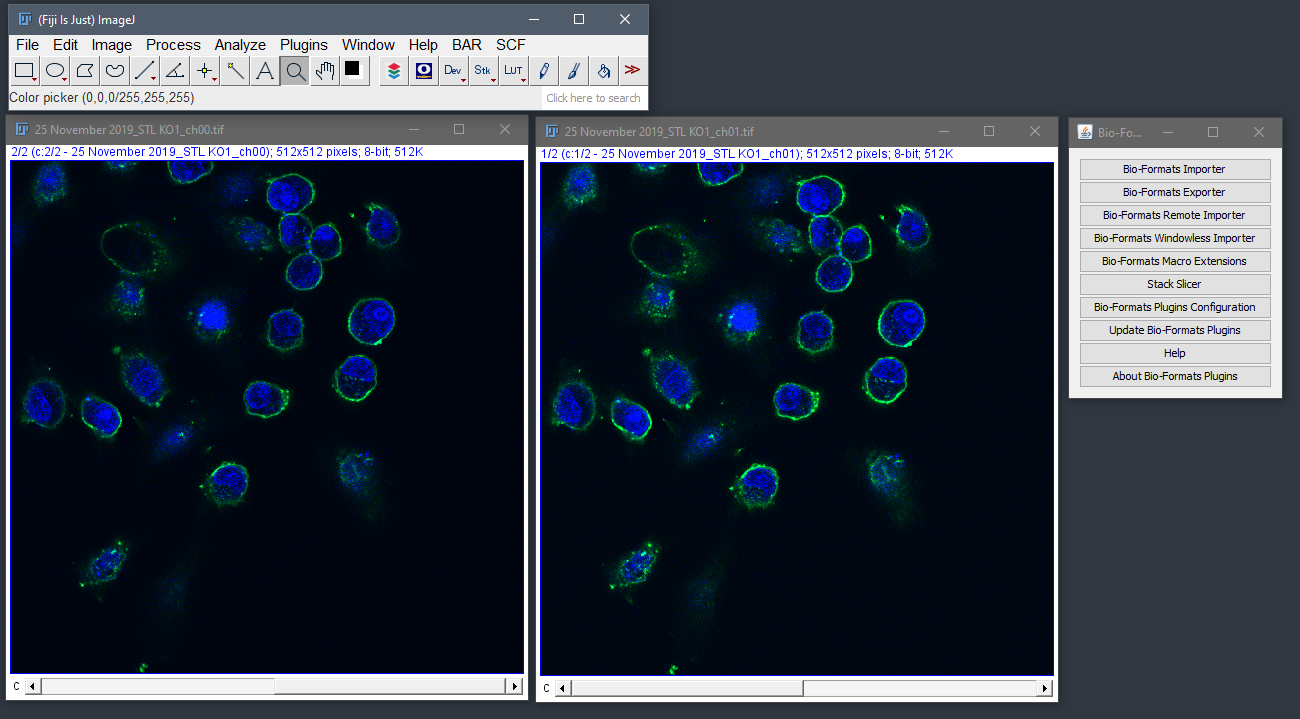 Use ImageJ to calculate the number of cells, nuclei and types of shapes ...