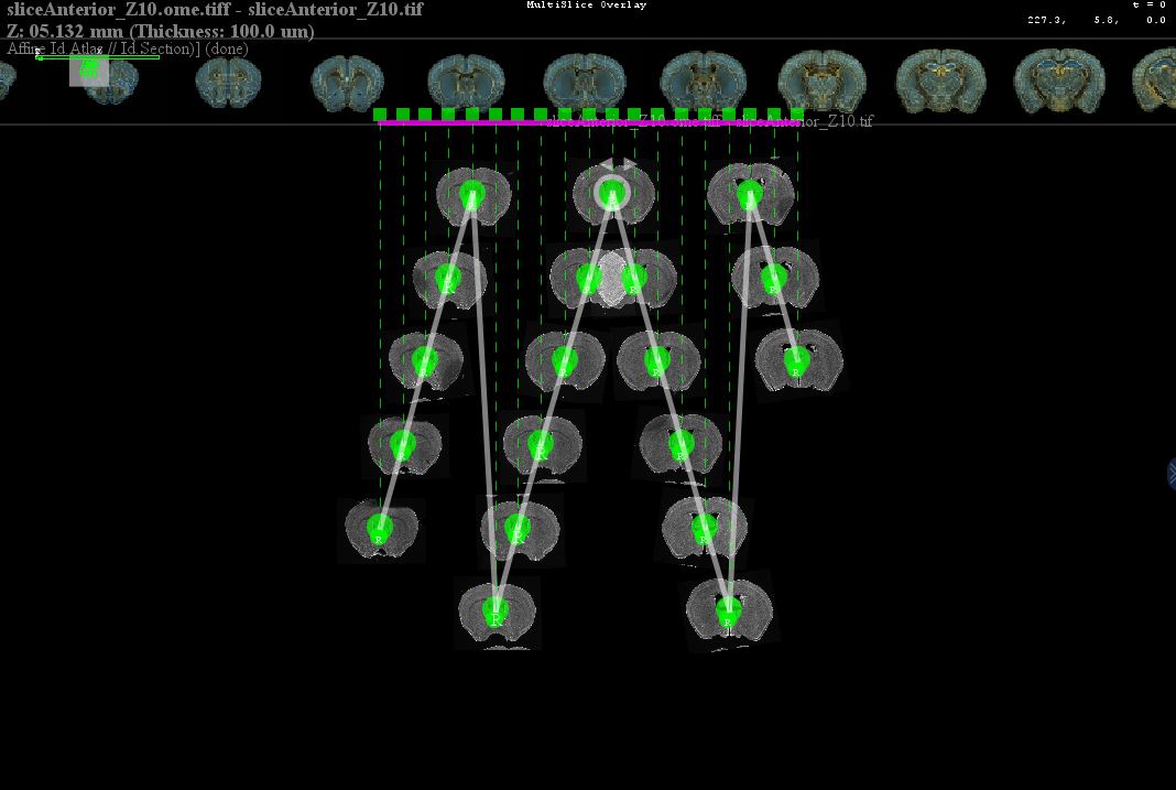 ABBA-python DeepSlice registration local is worse than web - Usage & Issues - Image.sc Forum