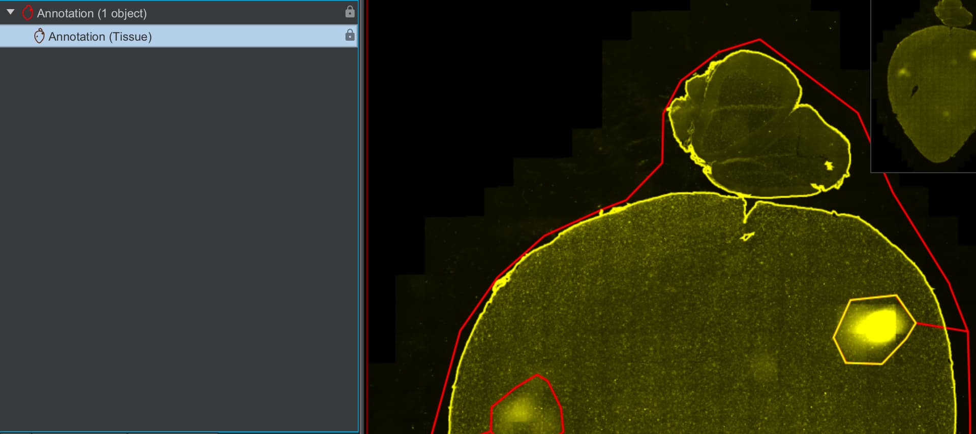 Pixel Classifier Applied to Annotations Not Working Properly - Usage & Issues - Image.sc Forum