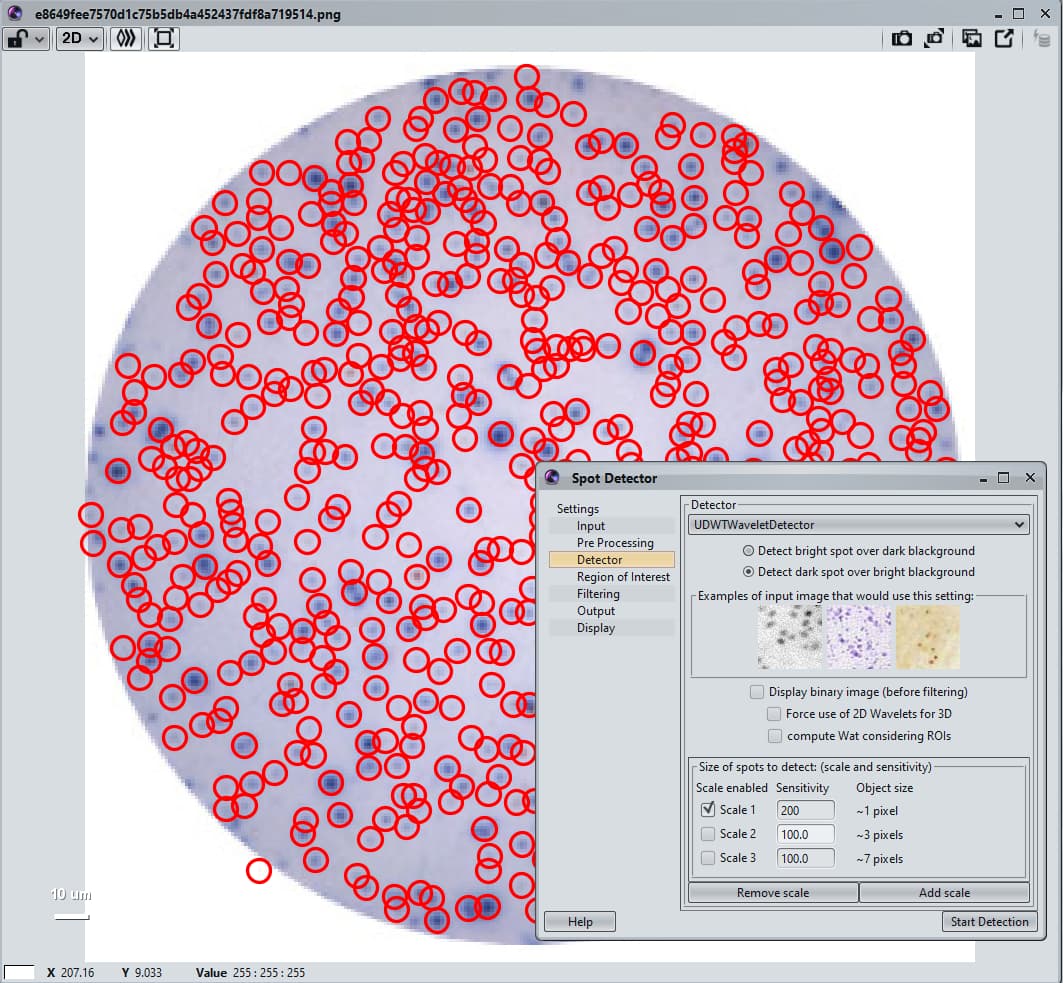 ELISPOT data analysis with cellprofiler or similar software - Image ...