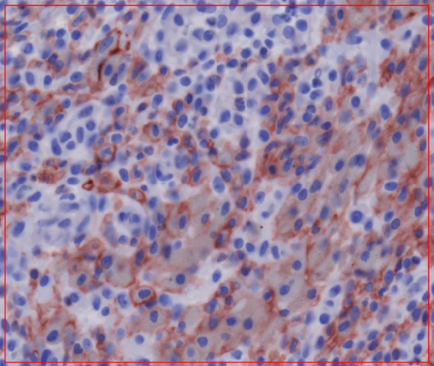 Positive cell detection - false positives - Image Analysis - Image.sc Forum