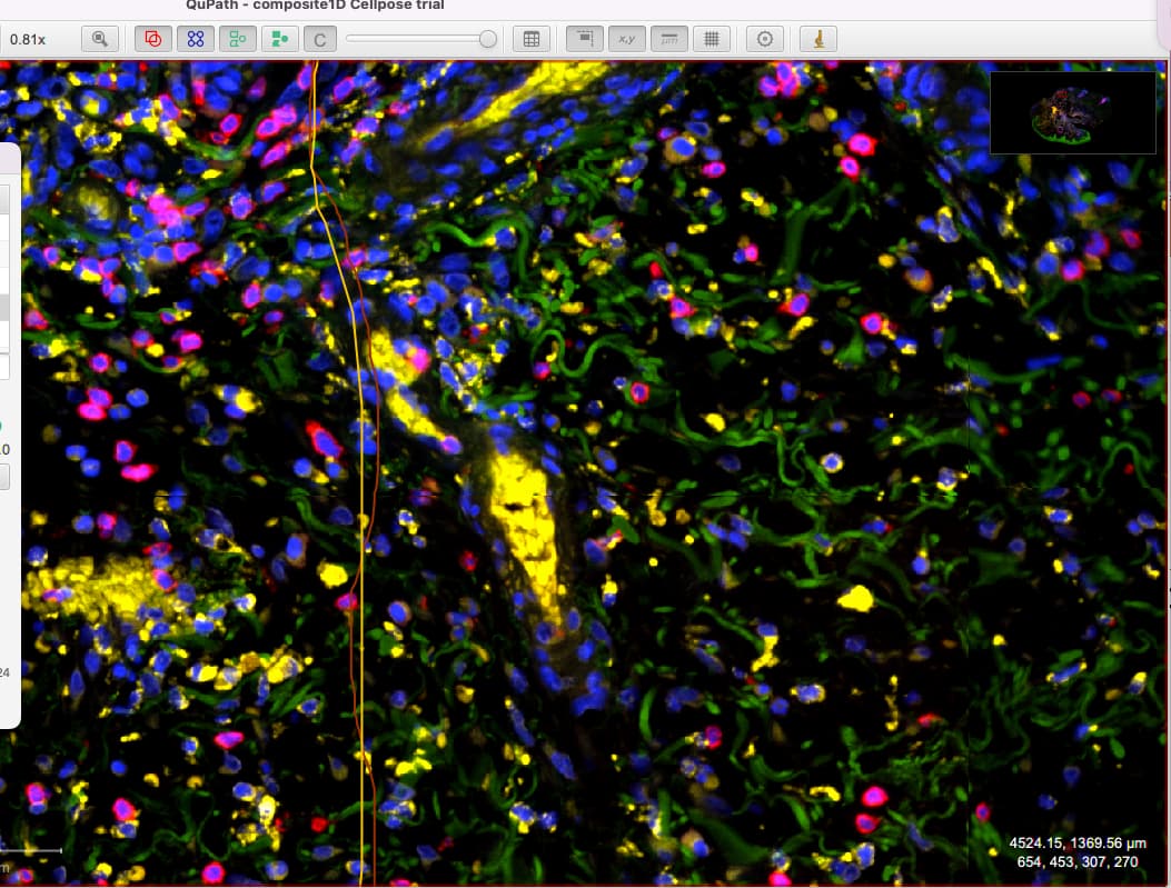 Qupath stardist on non-DAPI channels - Usage & Issues - Image.sc Forum