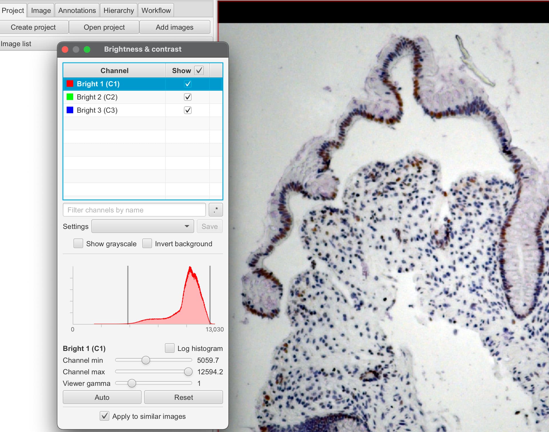 DAB quantification - Qupath - Image Analysis - Image.sc Forum