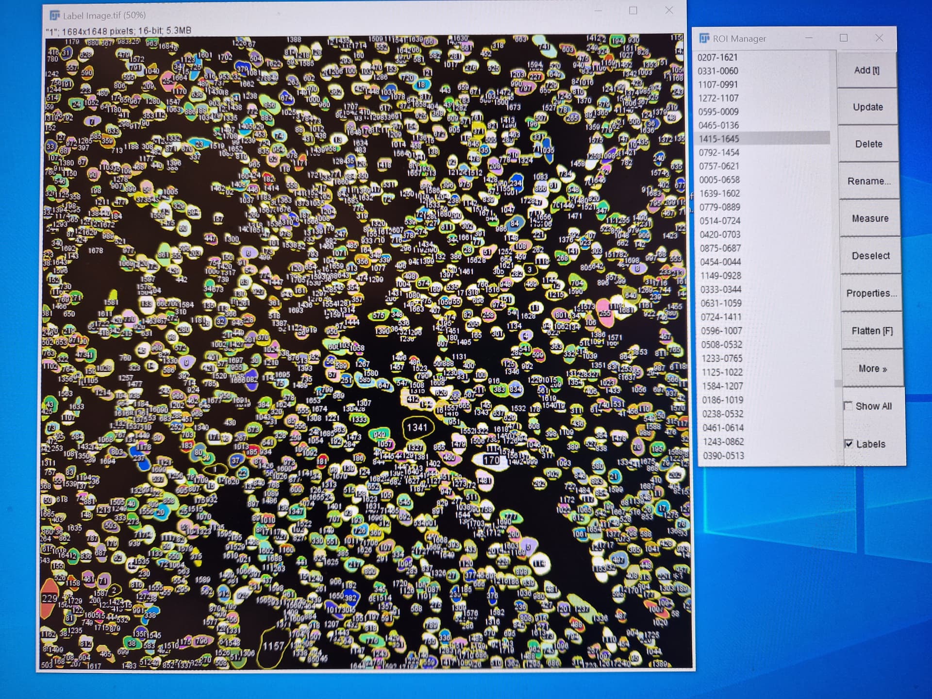 StarDist python nuclei segmentation - Image Analysis - Image.sc Forum