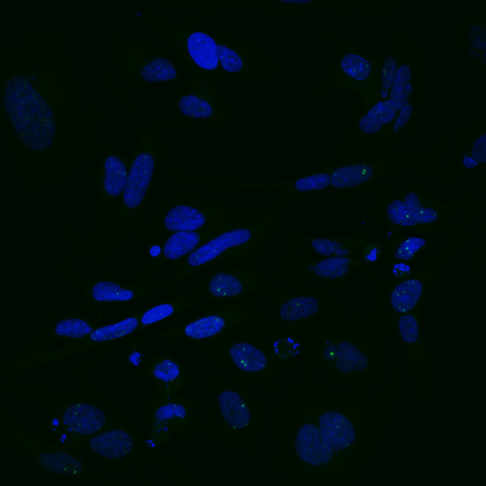 Automating ImageJ Color Thresholder User Input using a Macro/Java/Python - Image Analysis ...