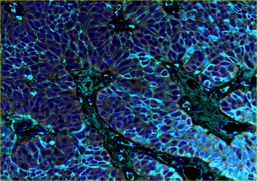Creating a script to generate 'Membranous' 'Intracellular' & 'Ubiquitous' classes from the ...