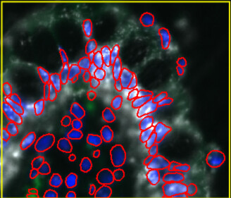 Stardist Cell expansion with Conditions - Image Analysis - Image.sc Forum