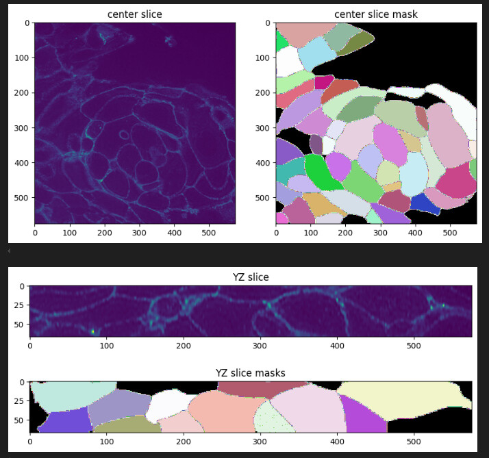 Cellpose 3D artifacts - Usage & Issues - Image.sc Forum