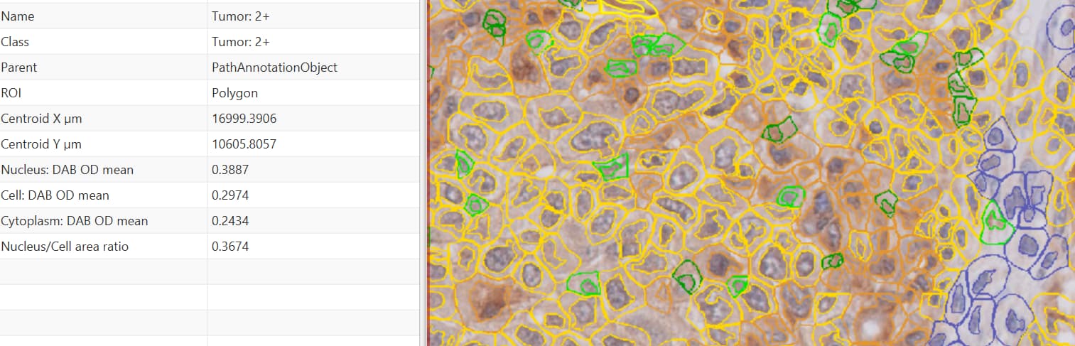 Qupath Cell Segmentation Membrane Cytoplasm Nucleus Signal Image Analysis Imagesc Forum