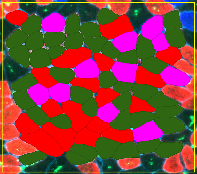 Subcellular Detection After Cellpose Segmentation Image Analysis Image Sc Forum